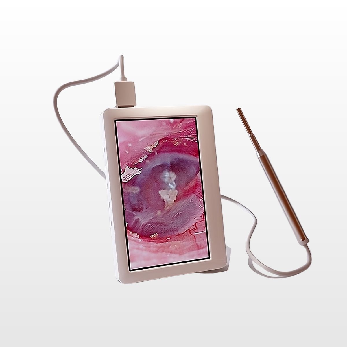 RINO OTOSCOPIO ULTRA LIGHT – Innovavet Chile